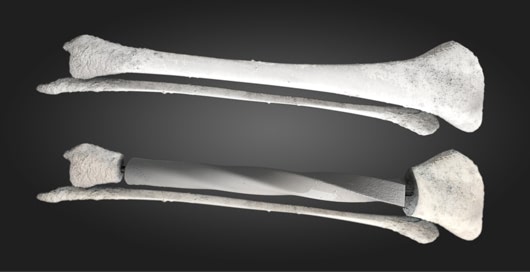 Swap Your Bones for an Improved, 3D-Printed Version | Next Nature