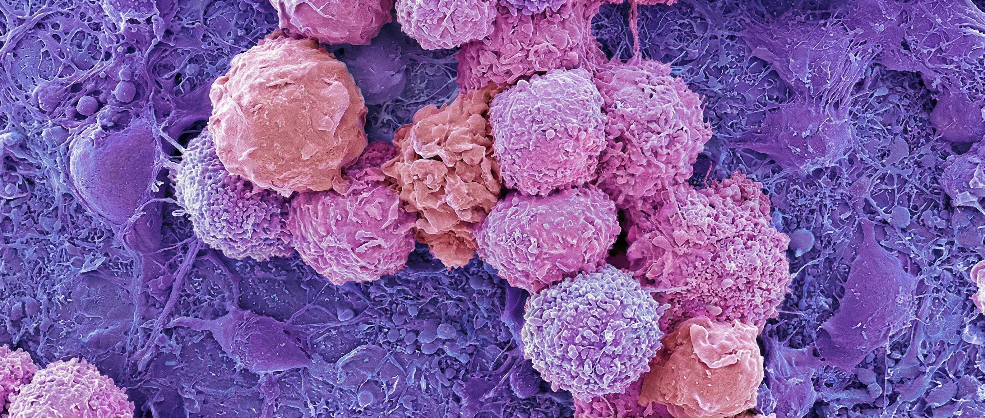 Computers made of brain cells: science fiction or reality? | Next Nature